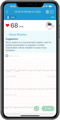 Wellue Pulsebit EX ECG Monitor. Take a Medical-grade EKG in Your Palm